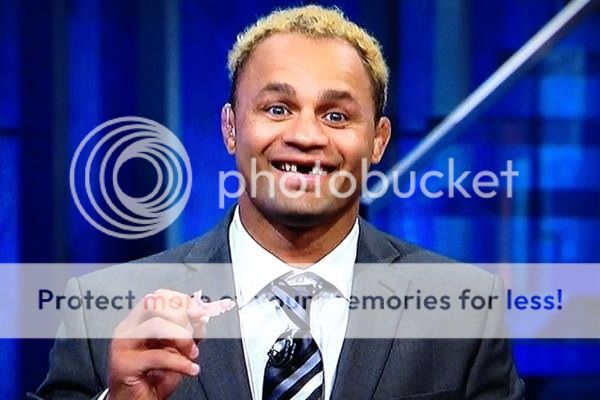 Fighters missing teeth | Sherdog Forums | UFC, MMA & Boxing Discussion